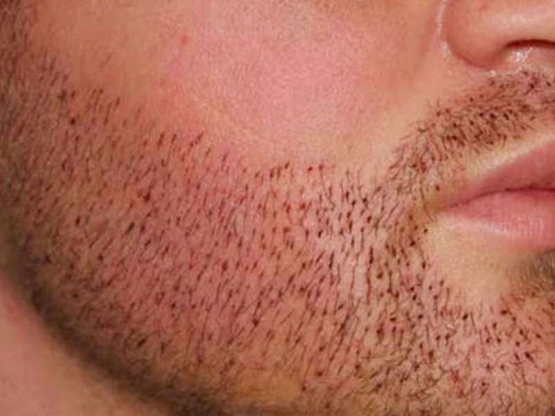 Las diez cirugías más extravagantes del mundo | Nortedigital