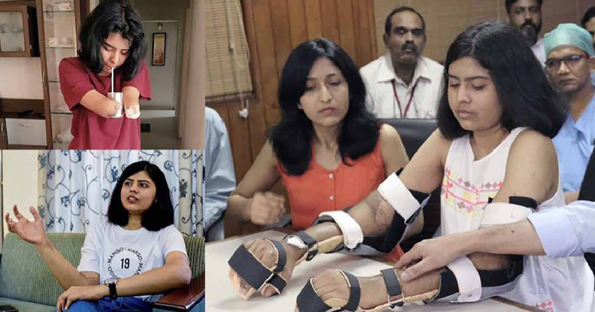 Sorprende mujer a la ciencia con transformación de sus brazos trasplantados