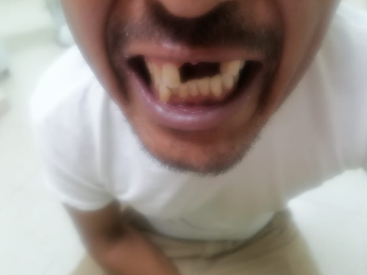 Iván Coronado, héroe ciudadano, recupera su dentadura tras perderla ...