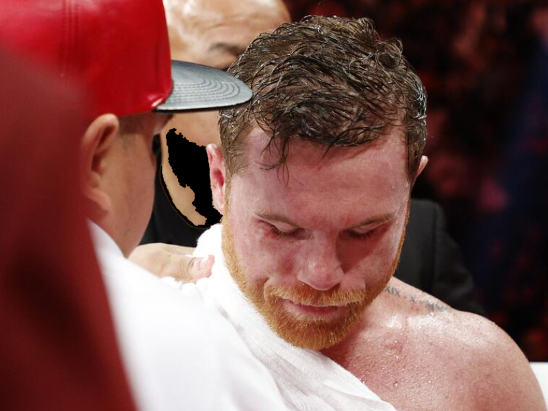 “Canelo” confiesa que sufrió parálisis facial por culpa del estrés ...