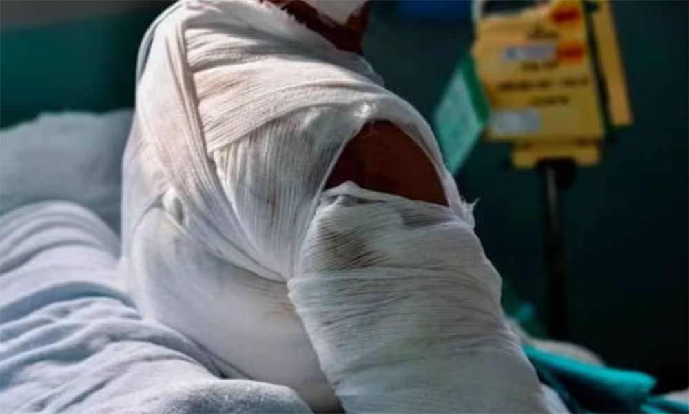 Sujeto rocía alcohol y le prende fuego a mujer en situación de calle la ...